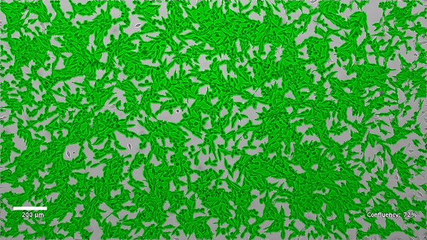 MC38 Murine Colon Adenocarcinoma Cell Line | SCC172